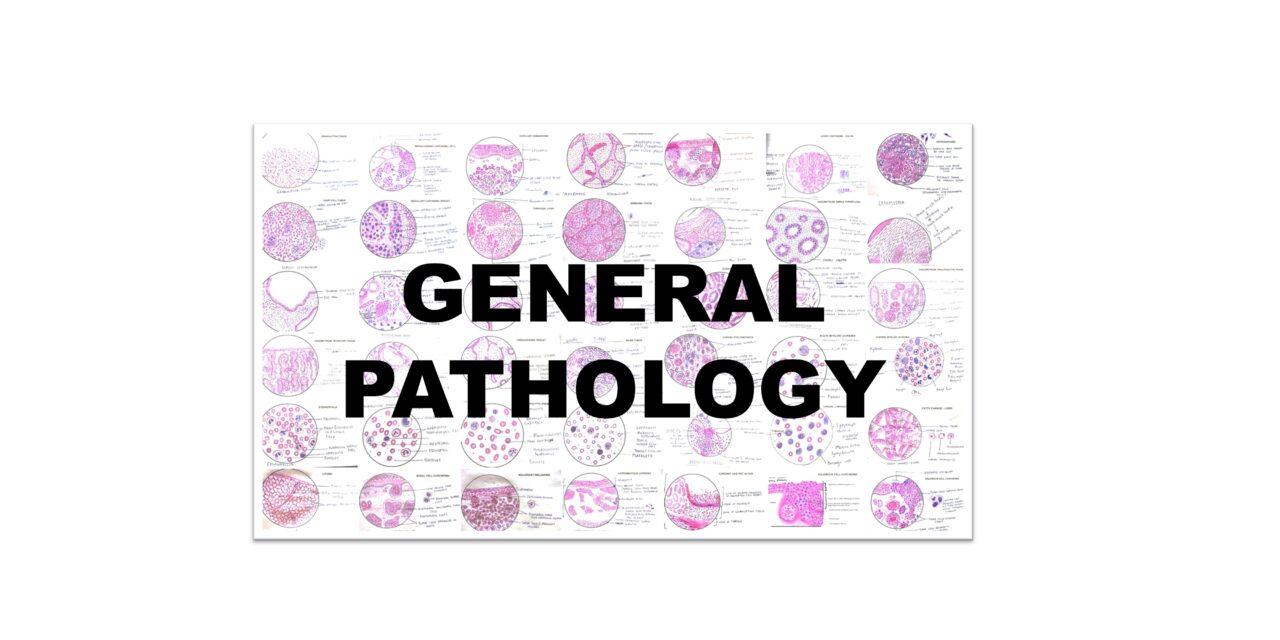 GENERAL PATHOLOGY Section1 Lecture (20241_080113021_AAUP - JENIN ...